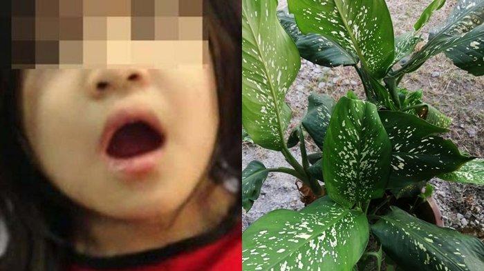 Gadis Kecil Ini Tak Sengaja Gigit Tanaman Hias, Mendadak Lidah Kejang ...