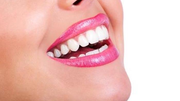 Ciri-ciri Gusi Sehat yang Wajib Anda Tahu - Sripoku.com