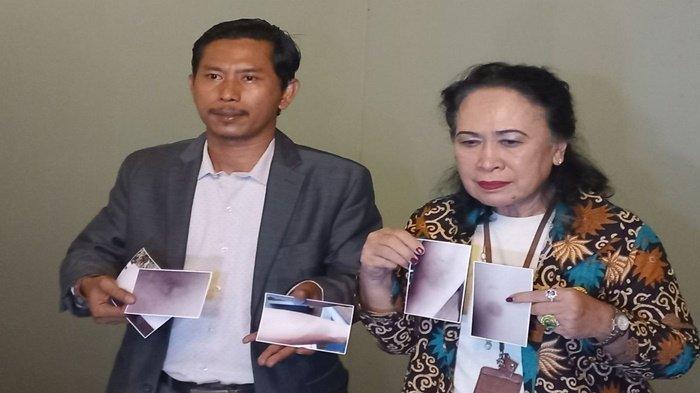 Kondisi Terkini Bani Idham Usai Diremas Istri di Depok, Alami Kembang ...