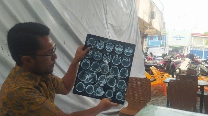Suara Hati Orangtua di Aceh, Anak Dikeroyok Kakak Kelas di Musala ...