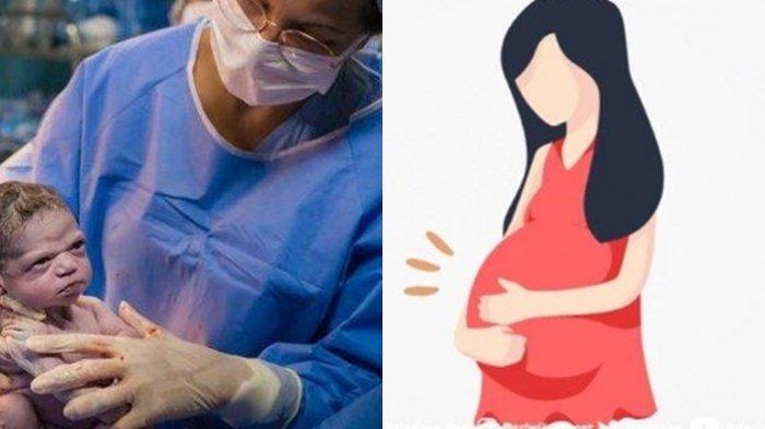 VIRAL Foto Bayi Cemberut yang Baru Dilahirkan, Ekspresi saat Keluar ...