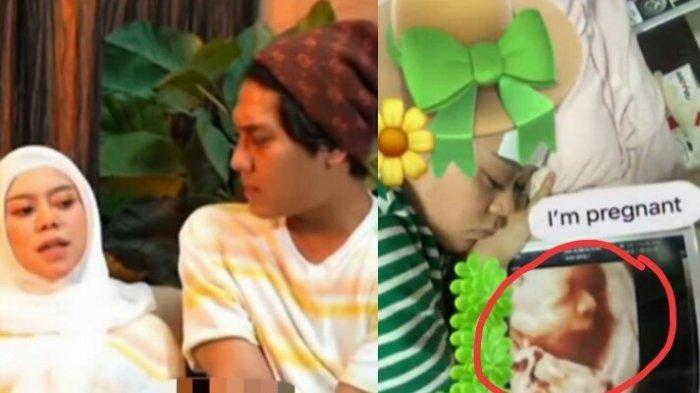 Lahir Lebih Cepat, Kelahiran Baby L Jadi Suatu Tanda, Denny Darko Kaget ...