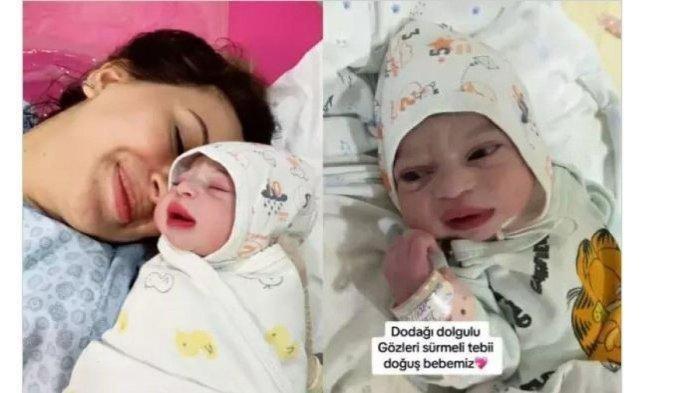Viral Wajah Bayi Baru Lahir Bak Dirias Make Up, Dokter Beri Julukan ...
