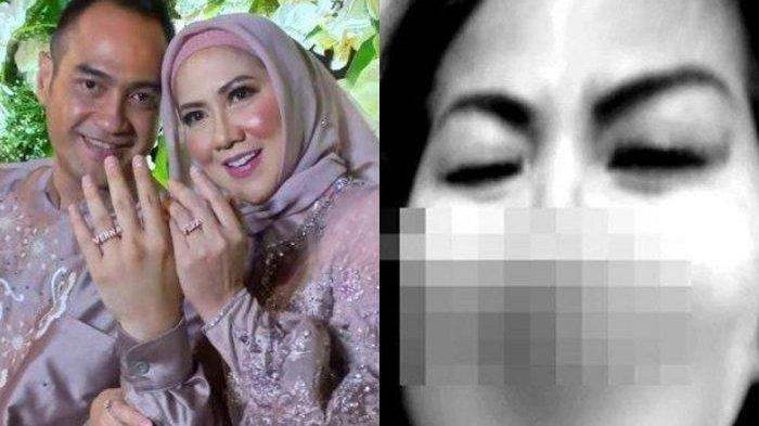 Bukan KDRT, Ferry Irawan Disebut Tekan Hidung Venna Melinda hingga Berdarah Hanya Karena Gemas ...