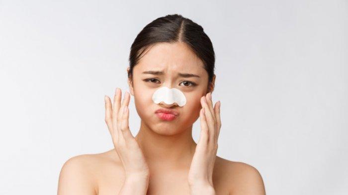 Apa Itu Komedo? Cari Tau Penjelasan, Penyebab, dan Cara Ampuh ...