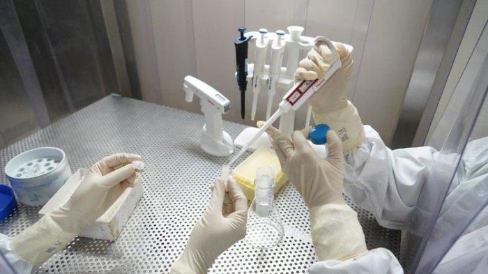 Biaya PCR di Indonesia Akan Diturunkan Jadi Rp 300 Ribu, Ini Tarif di ... Biaya PCR di Indonesia Akan Diturunkan Jadi Rp 300 Ribu, Ini Tarif di ...