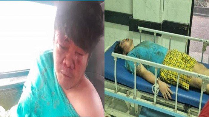 'Sudah Mau Meninggal Gitu Kok Diborgol' Edward Manurung Tak Kuasa ...