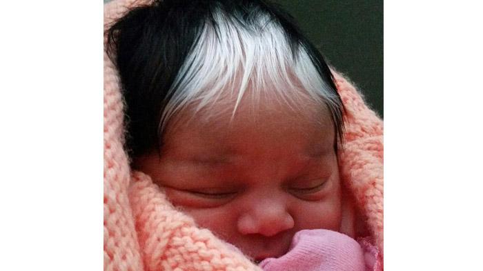 Empat Generasi Terlahir Punya Rambut Putih Termasuk Bayi Ini ...