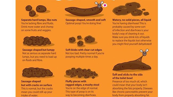 Bentuk dan Warna Kotoran Tak Biasa Bisa Jadi Tanda Bahaya, Cek Segera ...