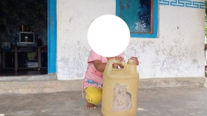 Balita 4 Tahun Kecanduan Hirup Aroma Pertalite, Menangis Saat Dilarang ...