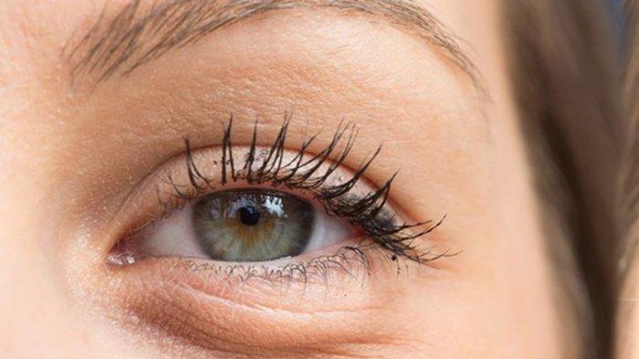 Cara Menghilangkan Kantung Mata Secara Alami, Bisa Pakai Lidah Buaya ...