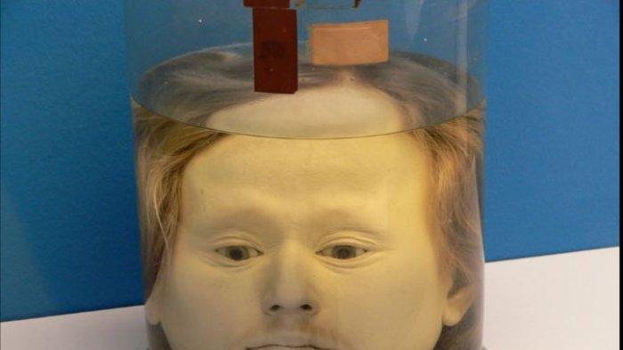 Kepala Pembunuh Berantai Ini Masih Segar Diawetkan di Dalam Toples ...