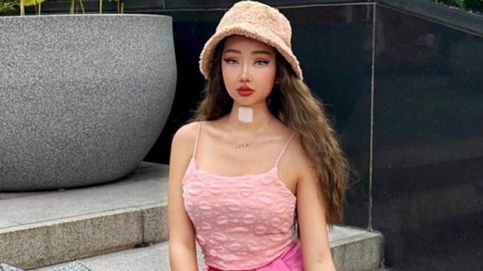 Bagian Tubuh Lucinta Luna yang Sukses Dioperasi, Leher, Mata, Jidat ...