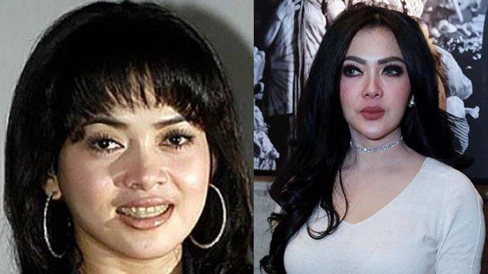 Coba Lihat Foto Perubahan Syahrini Dulu Hingga Sekarang, Bagian Rahang ...