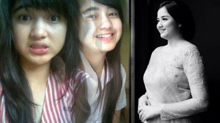 Viral Cewek Cantik Idola Generasi Friendster, Tirani Dwitasari Resmi Menikah - Halaman all ...