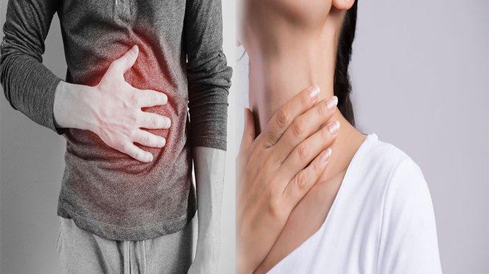 Pertolongan Pertama Ketika GERD Kambuh, 4 Ciri-Ciri yang Perlu Kamu ...