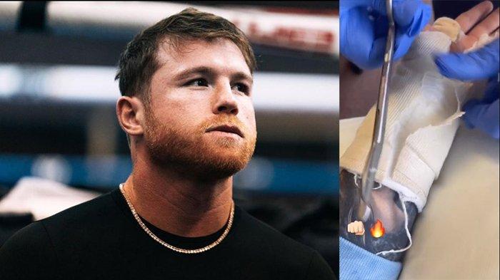 Canelo Beberkan Waktu Kembali ke Tinju Dunia Usai Operasi, Sang Juara ...