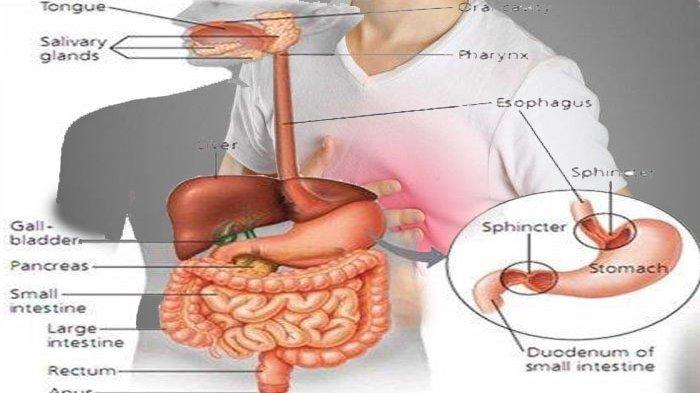 Seputar Penyakit Asam Lambung atau Gerd Akut dan Kenali Ciri-ciri dan ...