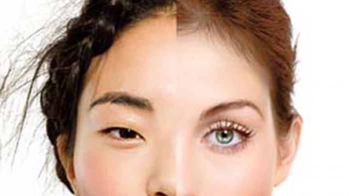 Dicky Smash Operasi Hidung