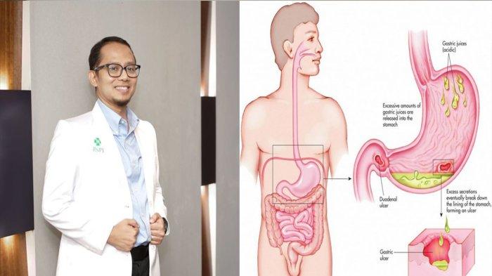 TANDA Gerd Sudah Sembuh yang Bisa Dirasakan Penderita Setelah Masa ...