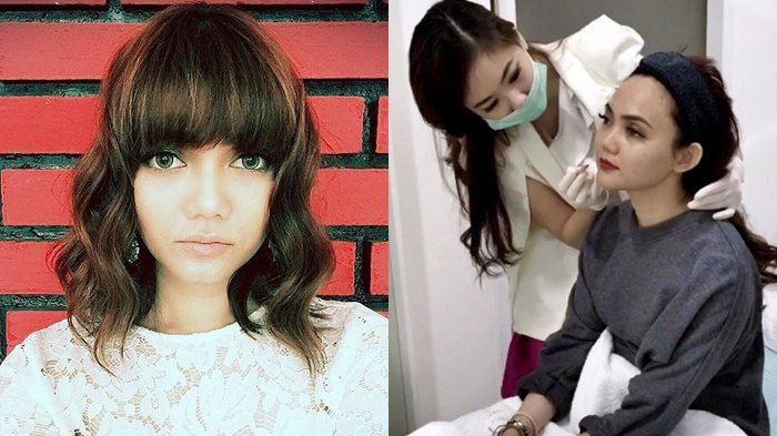 Tak Hanya Hidung, Ternyata Rina Nose Permak Bagian Tubuhnya yang ini ...