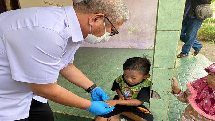 Apa Itu Penyakit Scabies, Berikut Penjelasan dan Berikut Cara ...