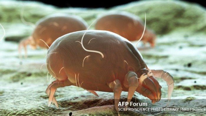 Sebabkan Alergi dan Gatal, Bagaimana Cara Mendeteksi Tungau Debu dan ...