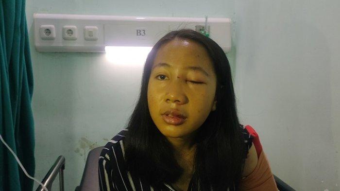 Lolos dari Maut, Begini Kesaksian Riska, Korban Kecelakaan Tol Cipali KM 139: Gak Ingat Apa-apa ...