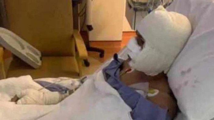 KONDISI Faisal Halim, Pemain Timnas Malaysia yang Disiram Air Keras ...