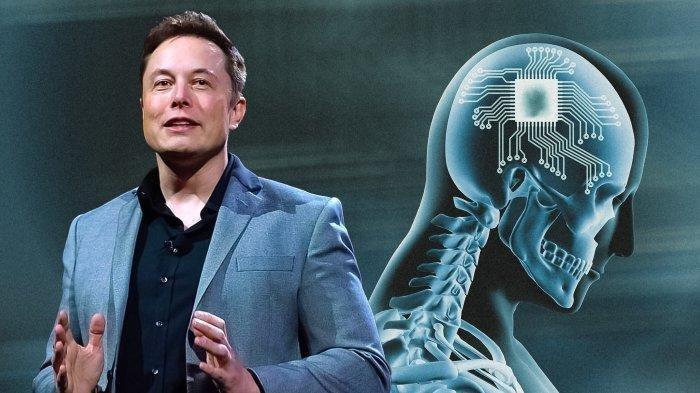 Elon Musk Lanjutkan Proyek Implan Chip ke Otak Manusia, Gaet Perusahaan ...