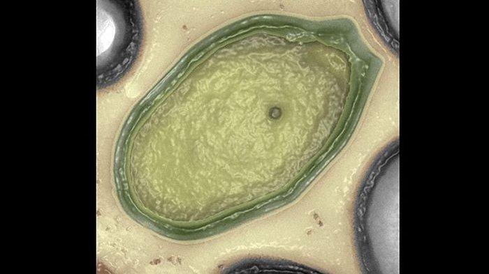 Virus Dihidupkan Lagi Setelah Puluhan Ribu Tahun Membeku - Halaman all ...