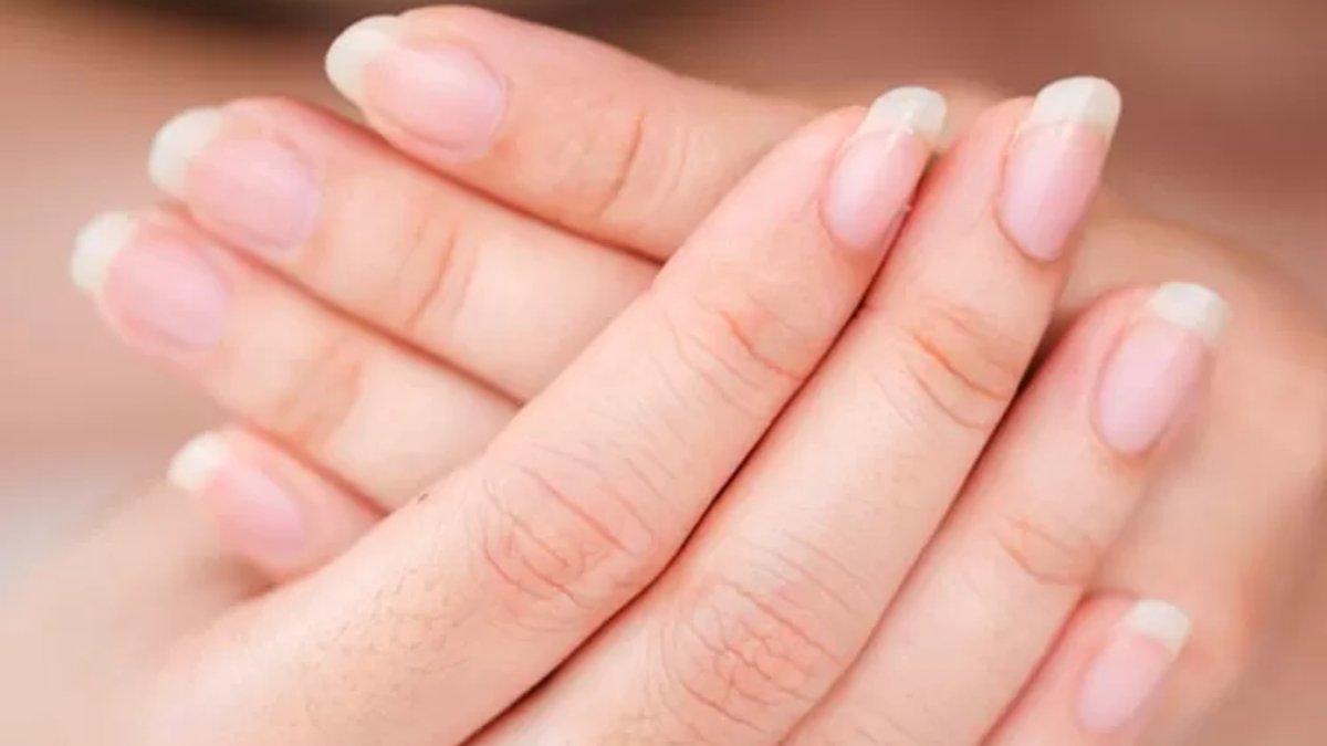 5 Bahan Alami Ini Bisa Kamu Manfaatkan untuk Merawat Kuku Agar Tidak ...