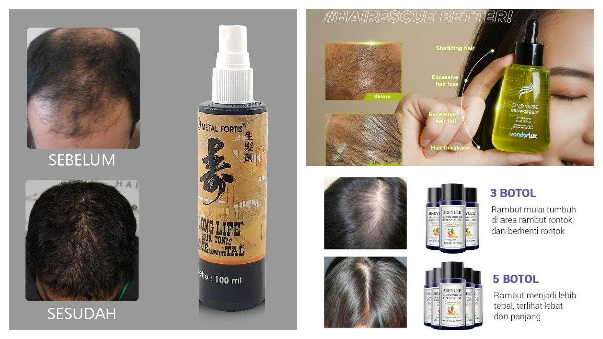 30 Daftar Produk Penyubur Rambut Terbaik yang Aman dan Sudah BPOM ...