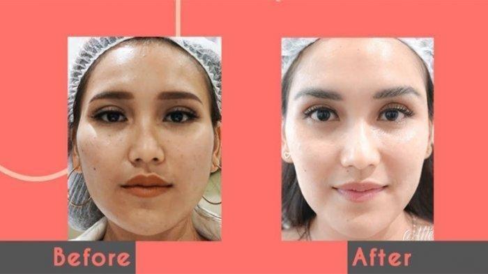 6 Tren Kecantikan Viral di Kalangan Artis dan Selebgram di Tahun 2023 ...