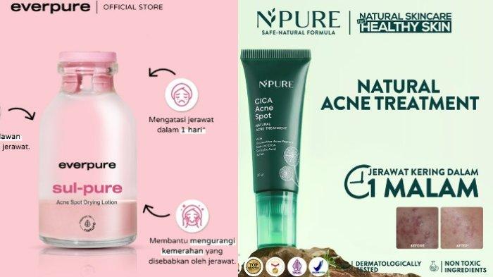 Battle Produk Acne Spot everpure vs NPURE, Apakah Sama-sama Ampuh ...