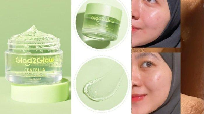 Review Glad2Glow Centella Allantoin Soothing Gel Moisturizer, Pelembap ...