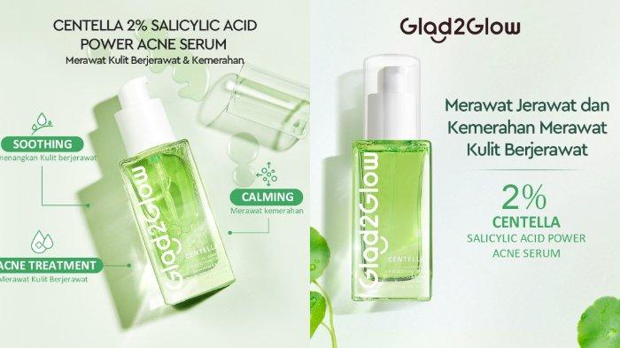 Review Glad2Glow 2 Percent Centella Ceramide Super Soothing Toner, Cocok untuk Meredakan Iritasi ...