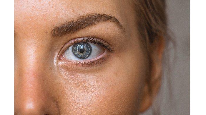 5 Cara Tepat Merawat Kulit Yang Sensitif