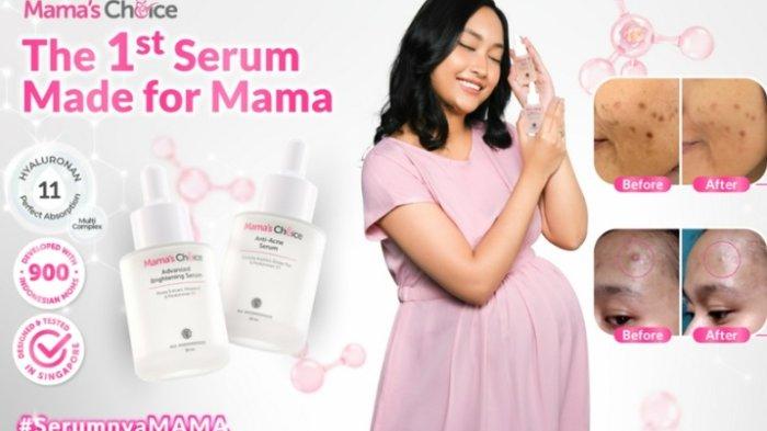 5 Rekomendasi Produk Mama's Choice yang Aman Dipakai untuk Ibu Hamil ...