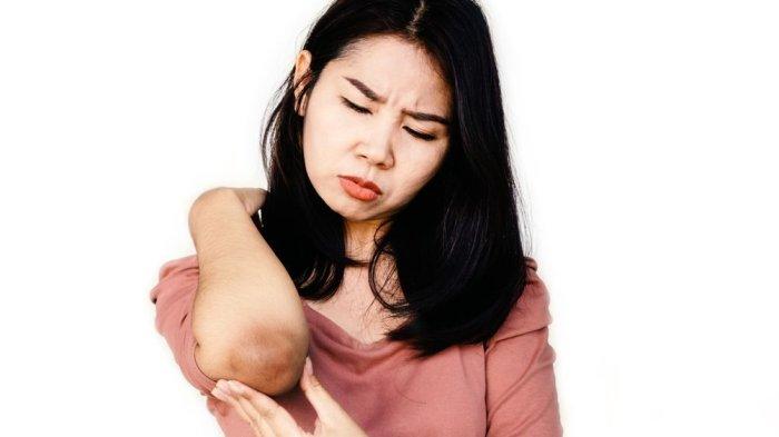Cara Ampuh Atasi Siku dan Lutut yang Menghitam Agar Cerah Kembali ...