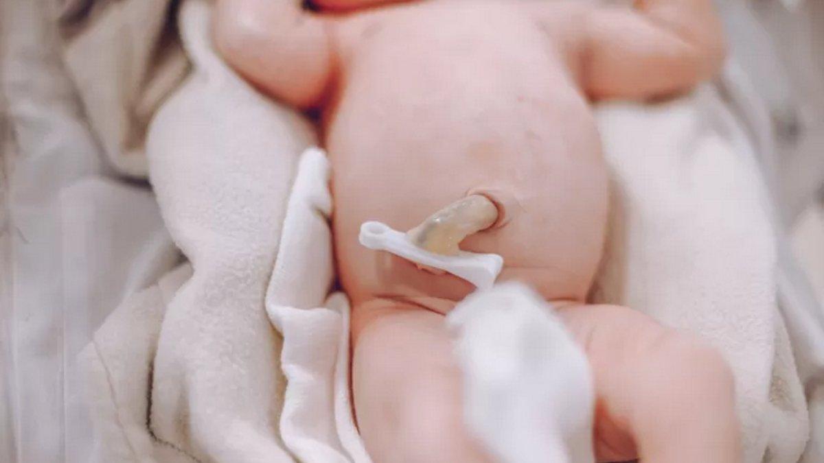 8 Langkah Perawatan pada Pusar Bayi yang Baru Lahir, Jangan Sampai ...