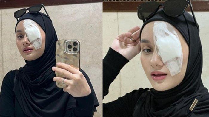 Cerita Dinda Hauw Jalani Operasi Kecil karena Kalazion, Sakit Mata ...