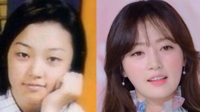 Karier Terancam Buyar, Song Hayoon Disebut Pernah Menampar Temannya 90 ...