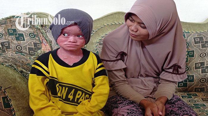 Harapan Orang Tua Daffa : Anaknya Bisa Segera Sembuh, Meski Tak Tahu ...