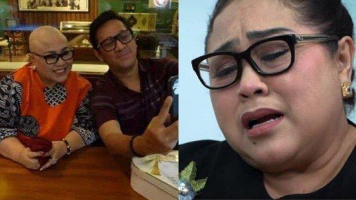 Kisah Nunung Botak Gara-gara Kemoterapi : Pekerja Salon Sampai Nangis ...