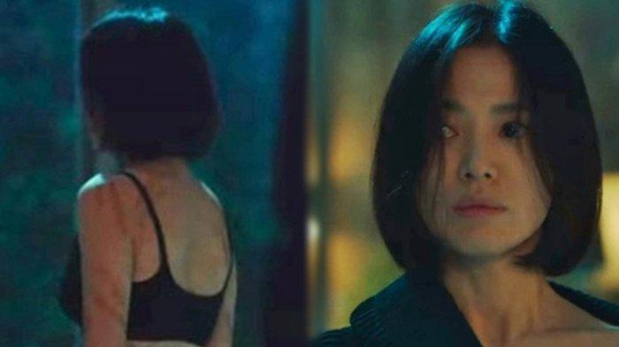 Tampilkan Tubuh Penuh Luka Moon Dong Eun di Drakor The Glory, Song Hye Kyo Malah Kena Body ...