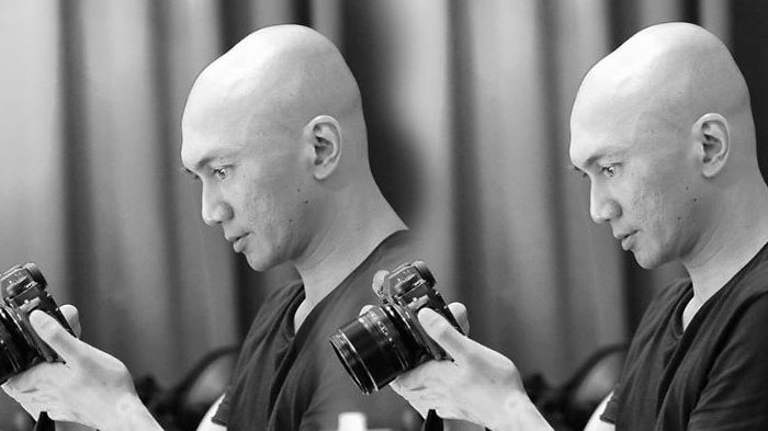 Punya Masalah Kebotakan? Anji Punya Tips untuk Tetap Keren dan Percaya ...