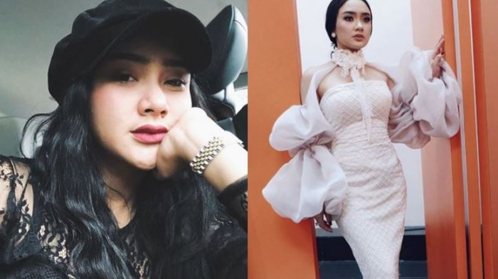 Rela Perawatan Sampai 'Dilas' Begini, Cita Citata Baper Dicibir Punya Ketiak Hitam? - Tribunsolo.com