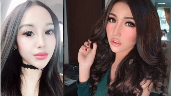 Lucinta Luna Operasi Plastik Habiskan Ratusan Juta, Wajahnya Disebut ...