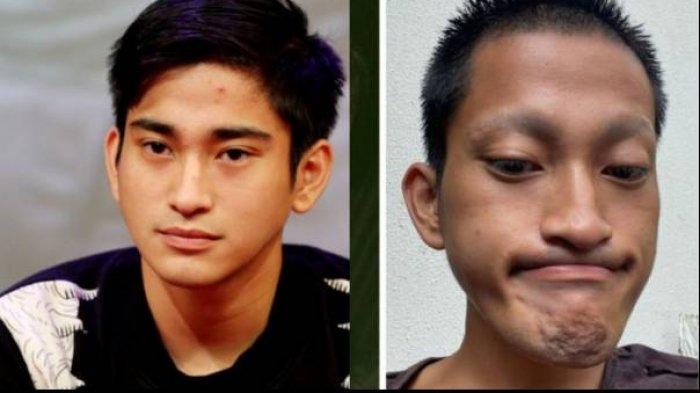 Transfomasi Penampilan Bio One, Kini Kurus Kering hingga Dikira Narkoba ...